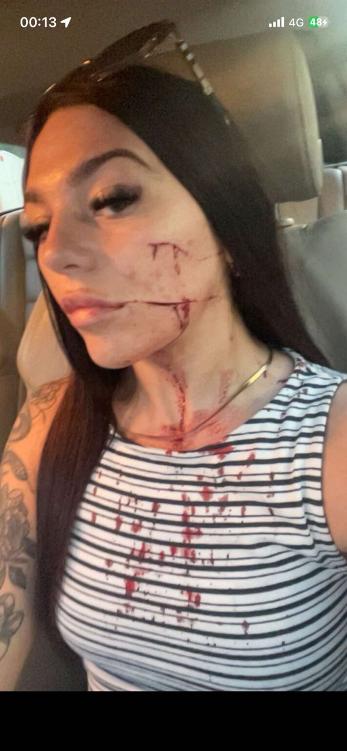 EXC: Belfast expat, 20, and wife of murder suspect has face slashed in ...